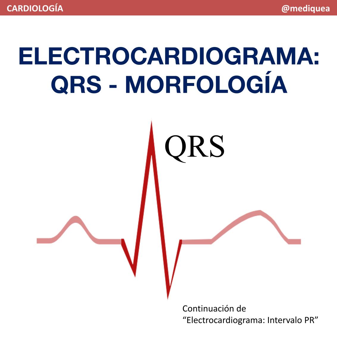 ECG: Morfología del QRS – MEDIQUEA ACADEMIA, S.L.