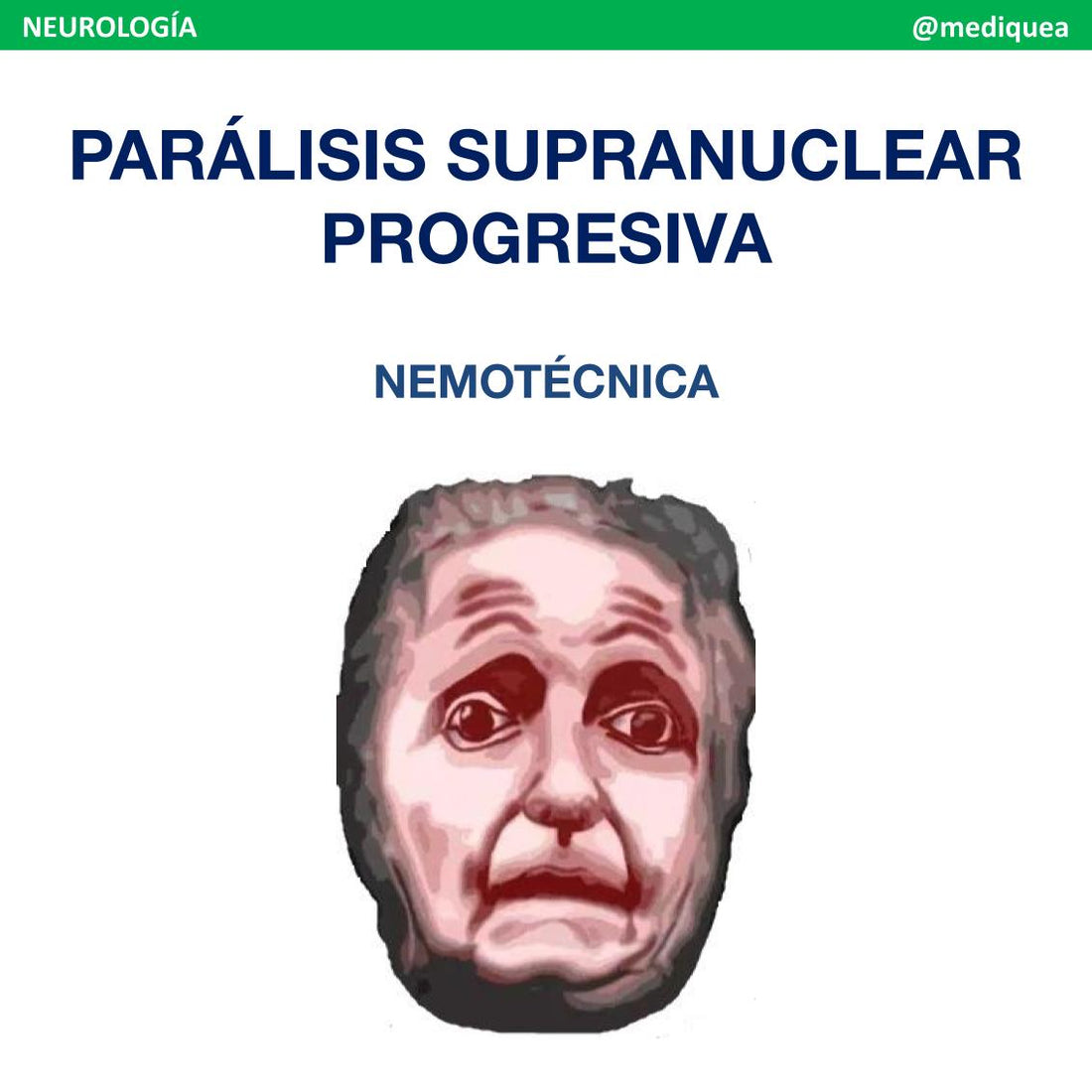 Parálisis Supranuclear Progresiva. Regla mnemotécnica – MEDIQUEA ...